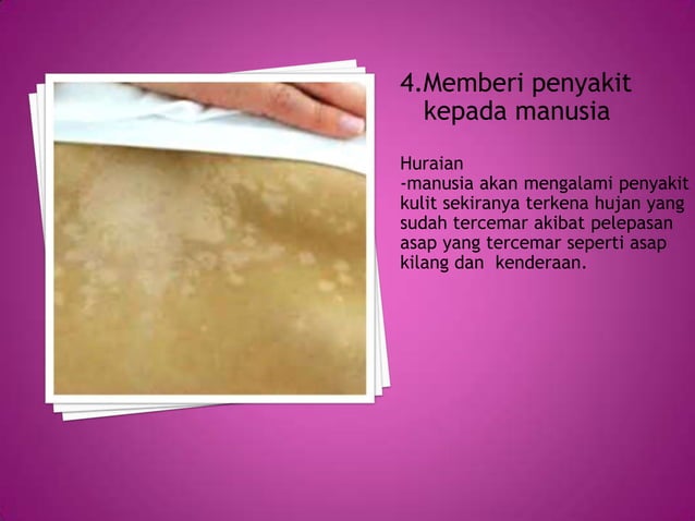 Punca Dan Kesan Rumah Hijau Pemanasan Global Dan