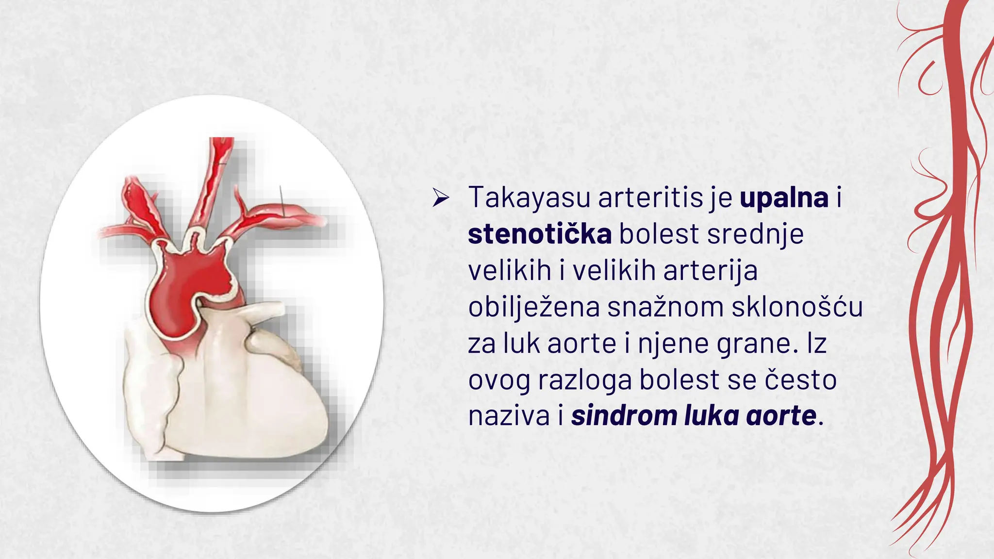 Takayasu arteritis.pptx