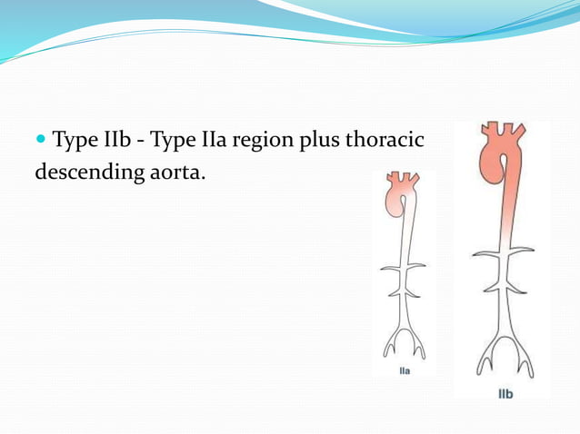 Takayasu's arteritis | PPTX | Heart and Cardiovascular Diseases ...