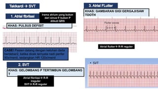 TAKIARITMIA dengan algoritma terbaru 4 kuadran oleh dokter syanindita | PDF