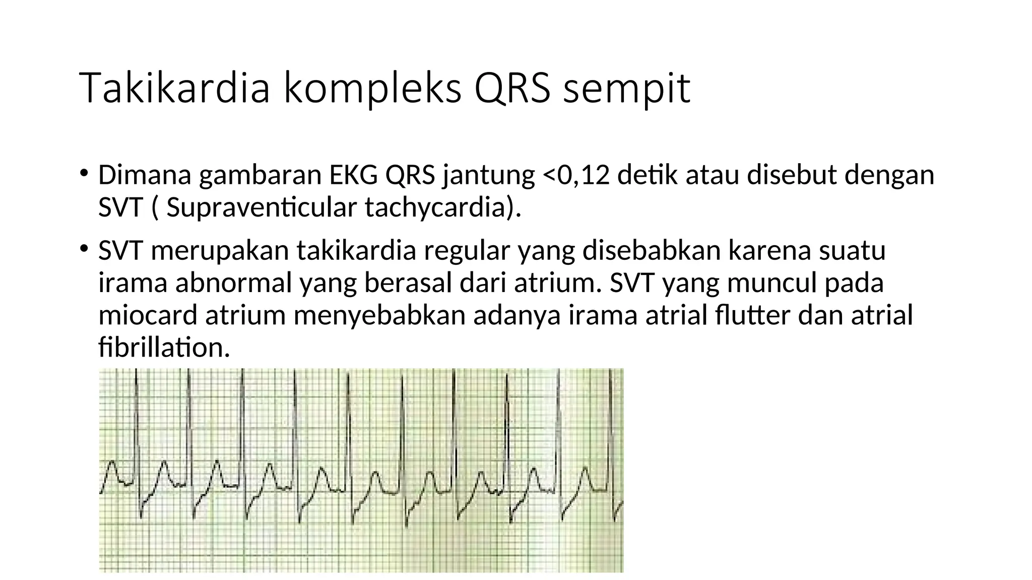 penanganan kasus TAKIKARDIA berdasarkan .ppt