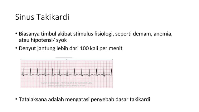 penanganan kasus TAKIKARDIA berdasarkan .ppt