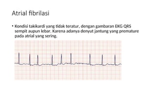penanganan kasus TAKIKARDIA berdasarkan .ppt