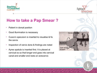 PAP test methods | PPT