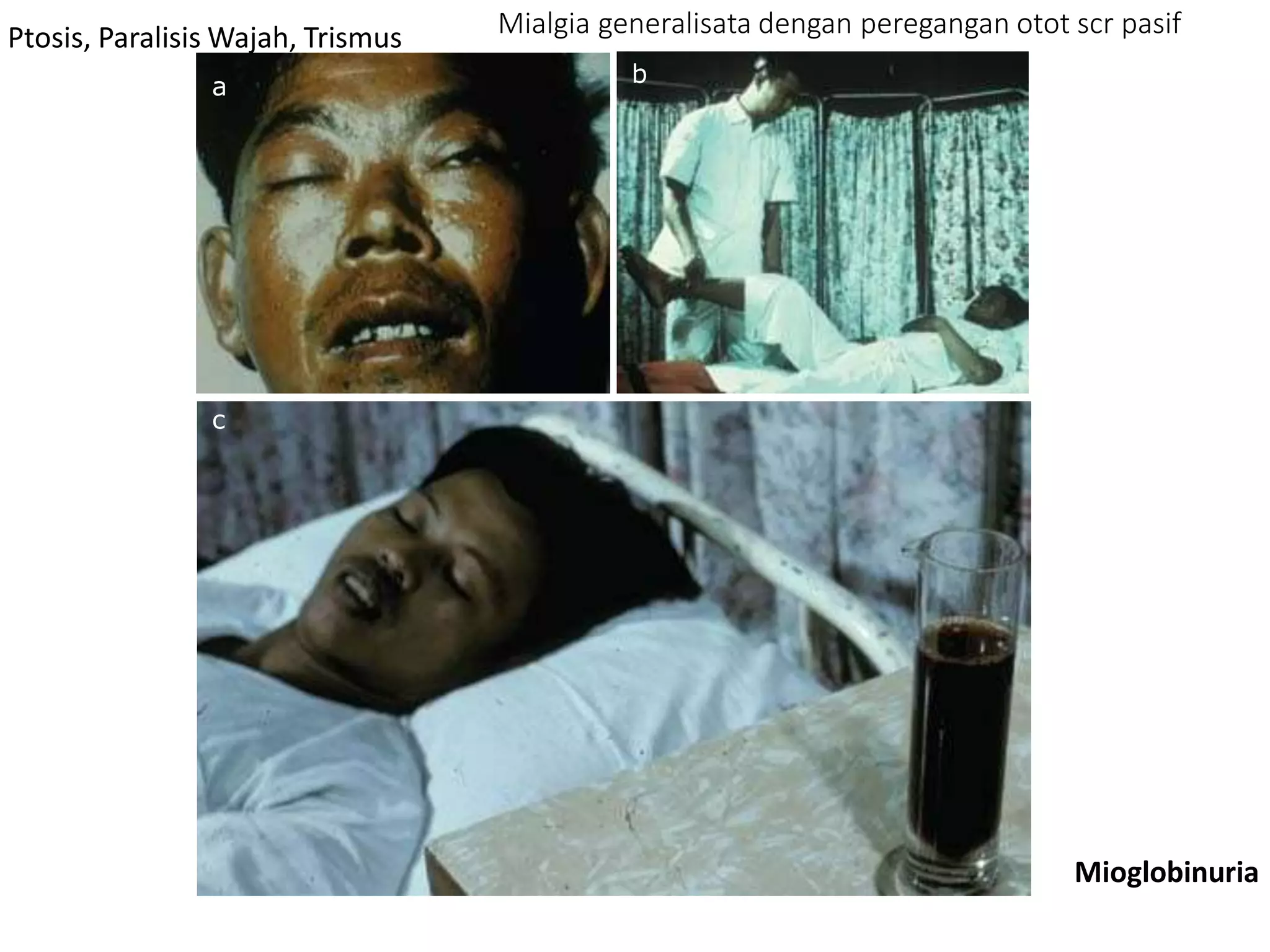 talak snakebike 2.pptx