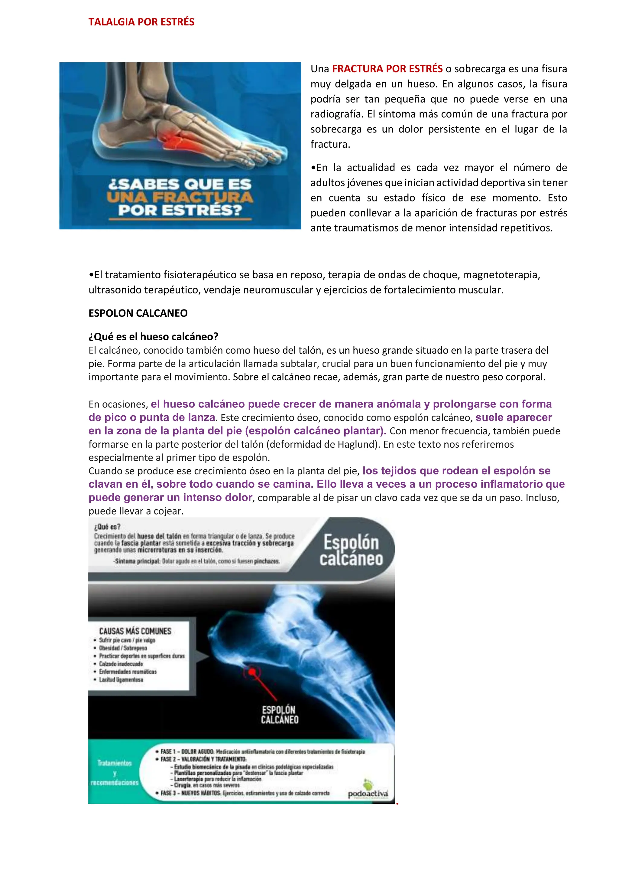TALALGIA.TERAPIA Y REHABILITACION FISICA | DOCX