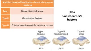 AJM Sheet: Talar fracture | PPTX | Death, Injury, or Military Conflict ...
