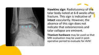 AJM Sheet: Talar fracture | PPTX | Death, Injury, or Military Conflict ...