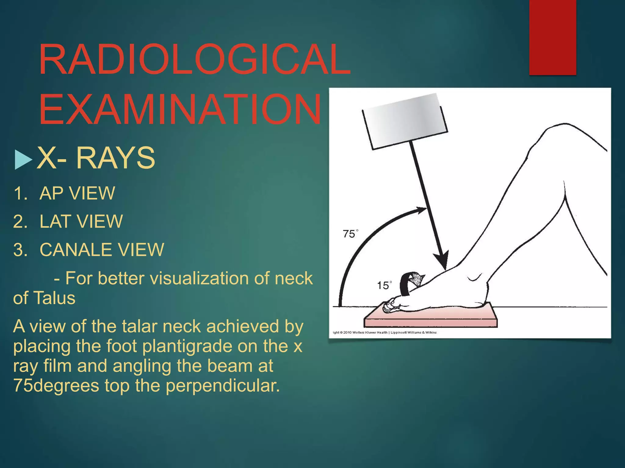 TALUS FRACTURE AND MANAGEMENT. | PPTX