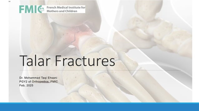 Talar Fractures (Fractures of Talus Bone).pptx