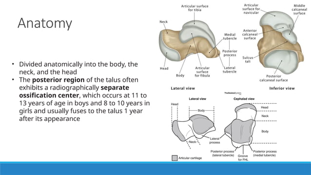 Talar Fractures (Fractures of Talus Bone).pptx