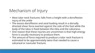 Talar Fractures (Fractures of Talus Bone).pptx