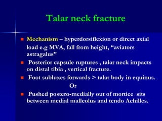 Talar fractures2 | PPT