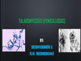 TALAROMYCOSIS - Introduction, Morphology, Epidemiology, Clinical ...