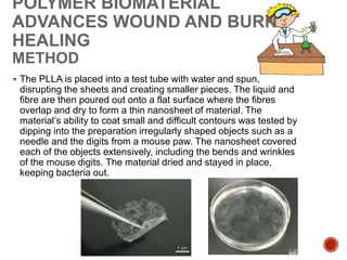 Polymers, Polymer Biomaterial Advances Wound and Burn Healing | PPTX