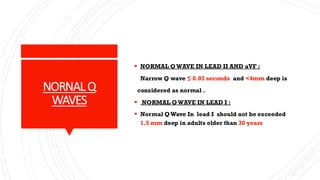 ECG Q wave abnormalities briefly presentation calsspdf | PDF