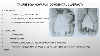 Talipes equanovarus and valgus.pptx as congenital disorder | PPTX