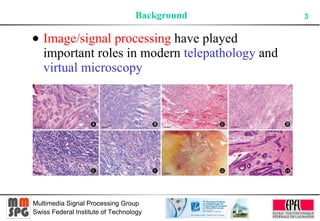 Towards second generation expert systems in telepathology for aid in ...