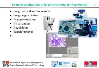 Towards second generation expert systems in telepathology for aid in ...