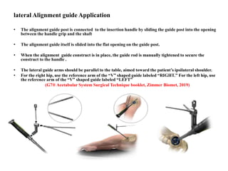 Acetabular component alignment guide in total hip replacement | PPTX