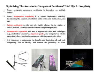 Acetabular component alignment guide in total hip replacement | PPT
