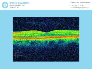 Talk by peter simcock on elderly eyes to national geriatrics society | PPT