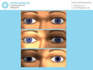 Talk by peter simcock on elderly eyes to national geriatrics society | PPT