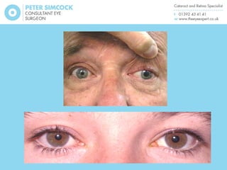 Talk by peter simcock on elderly eyes to national geriatrics society | PPT