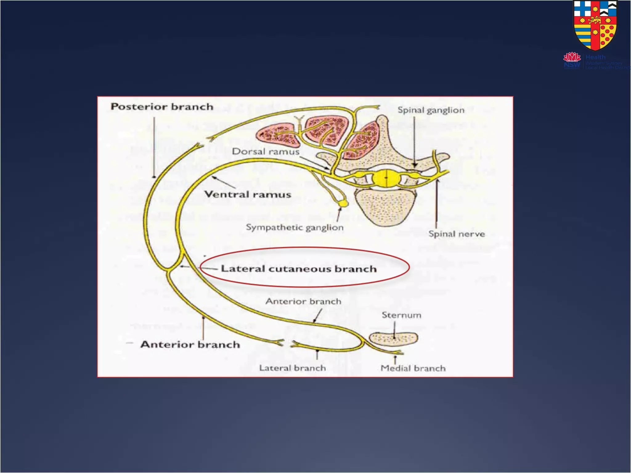 Serratus Anterior Plane Block | PPT