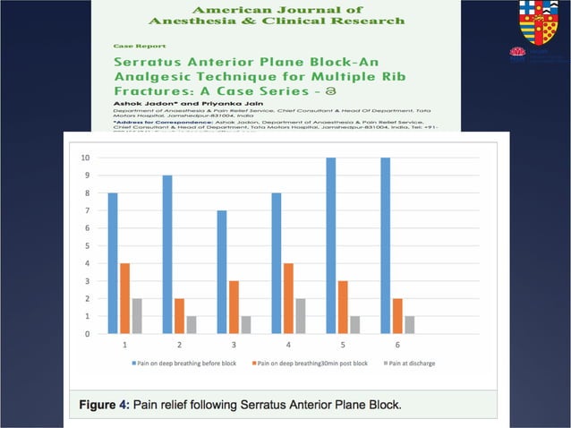 Serratus Anterior Plane Block | PPT