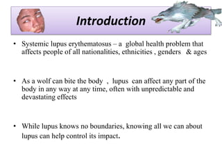 talking lupus.pptx