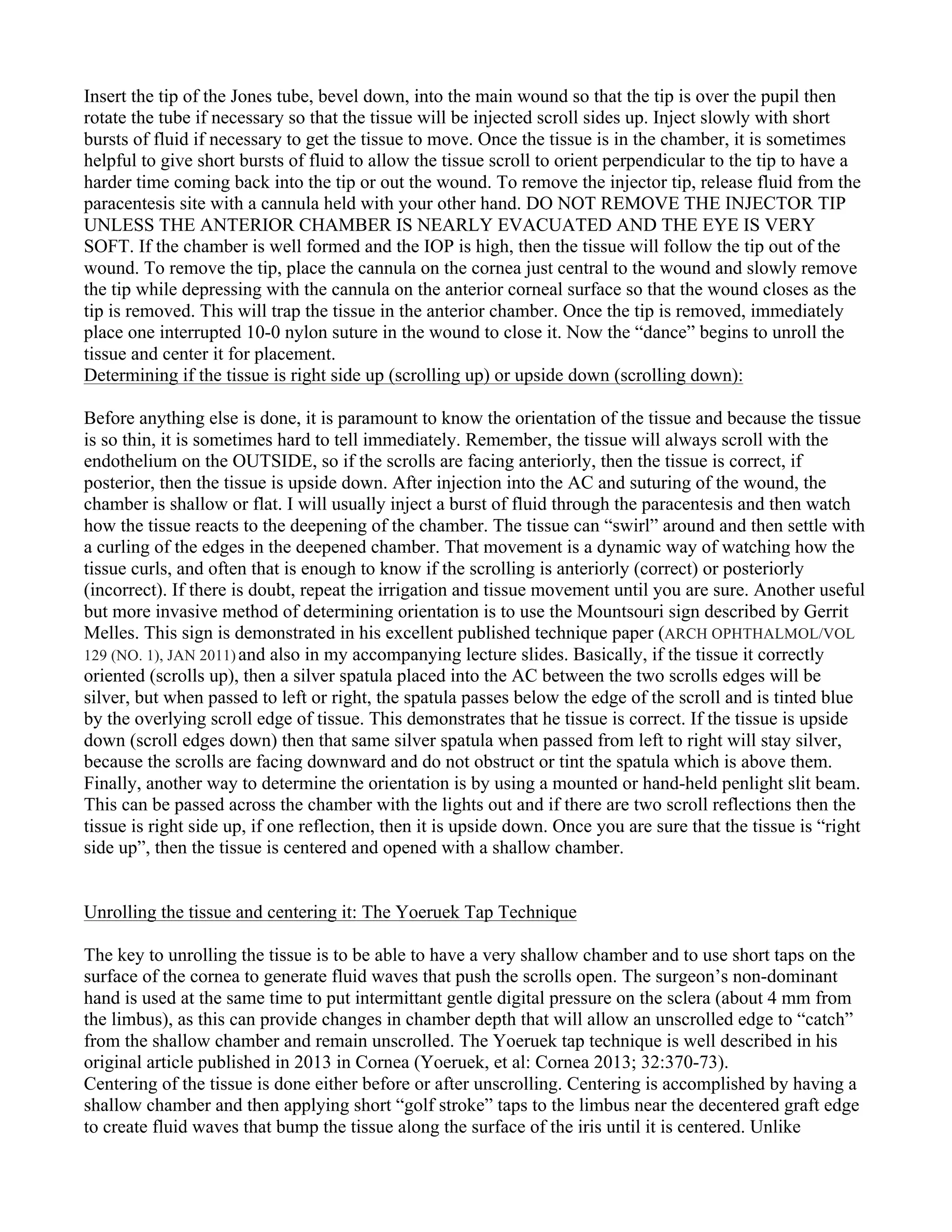 lamellar keratoplasty, DMEK, DSAEK, Cornea Transplant | PDF