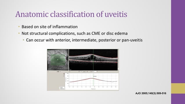 Uvetis, anterior uveitis, posterior uveitis | PDF