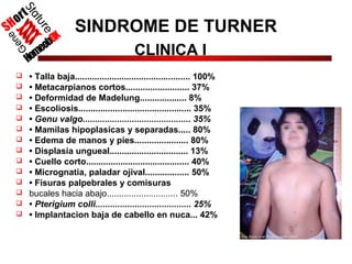 Talla baja por turner y shox | PPT