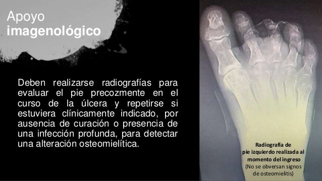 Taller #1: Necrosis en Ortejo