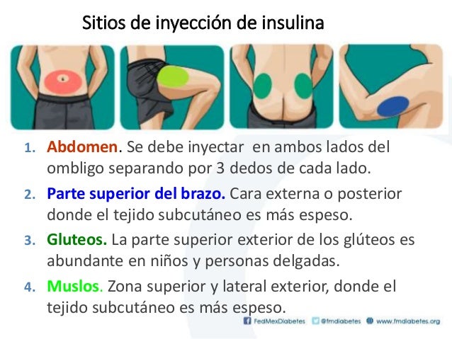 Zonas De Inyección De La Insulina Njula