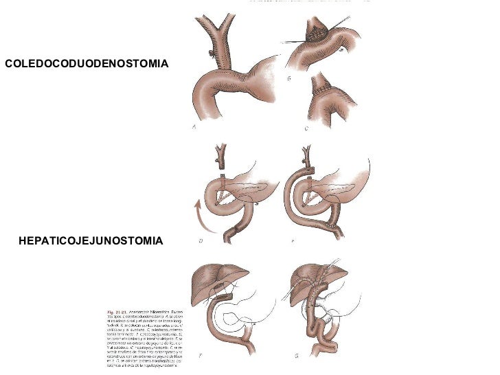 Taller cirurgia presentacio