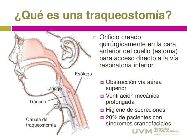 Cuidados de Traqueostomía Pediátrica
