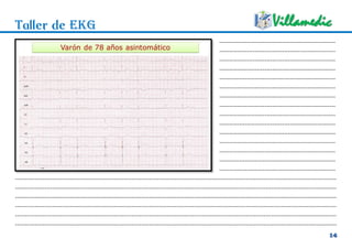 Taller de ekg | PDF