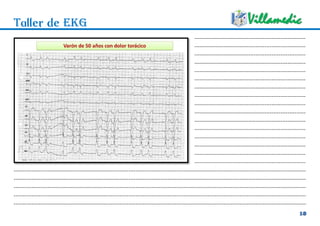 Taller de ekg | PDF