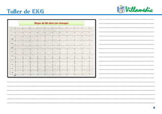 Taller de ekg | PDF