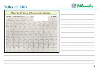 Taller de ekg | PDF