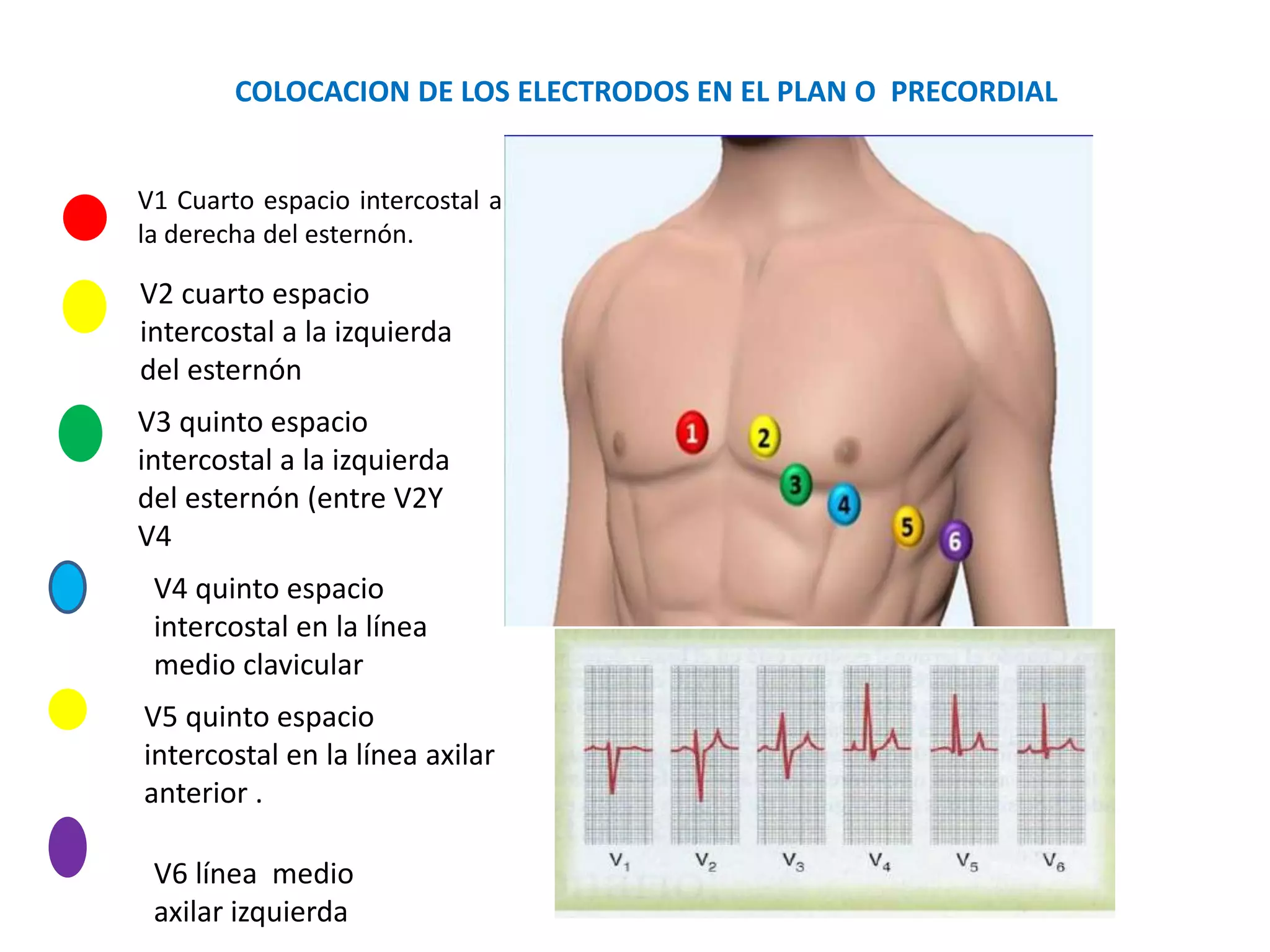 Taller De Electrocardiograma En Enfermeria Pdf