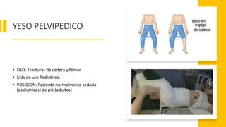 TALLER DE INMOBILIZACION DE YESO EN MEMBRO SUPERIOR | PDF