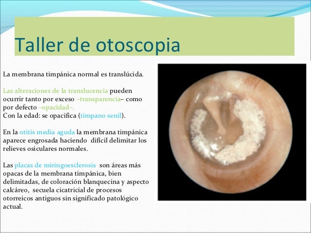 Taller de otoscopia