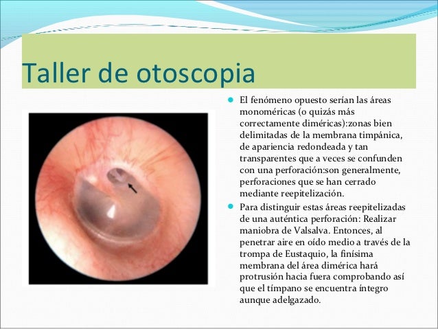 Taller de otoscopia