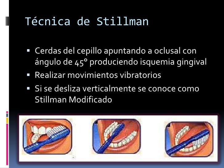 Taller de Salud Periodontal