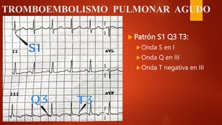 TALLER ECG parte 2.pptx