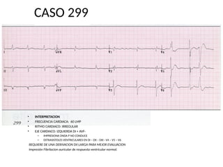 TALLER DE ELECTROCARDIOGRAMA, BASES DEL ANALISIS | PPTX