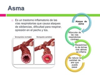 Taller enfermedades respiratorias | PPTX
